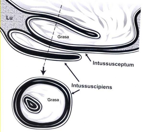 Intususcepción Ileocecal – Acupuntura Veterinaria Costa Rica